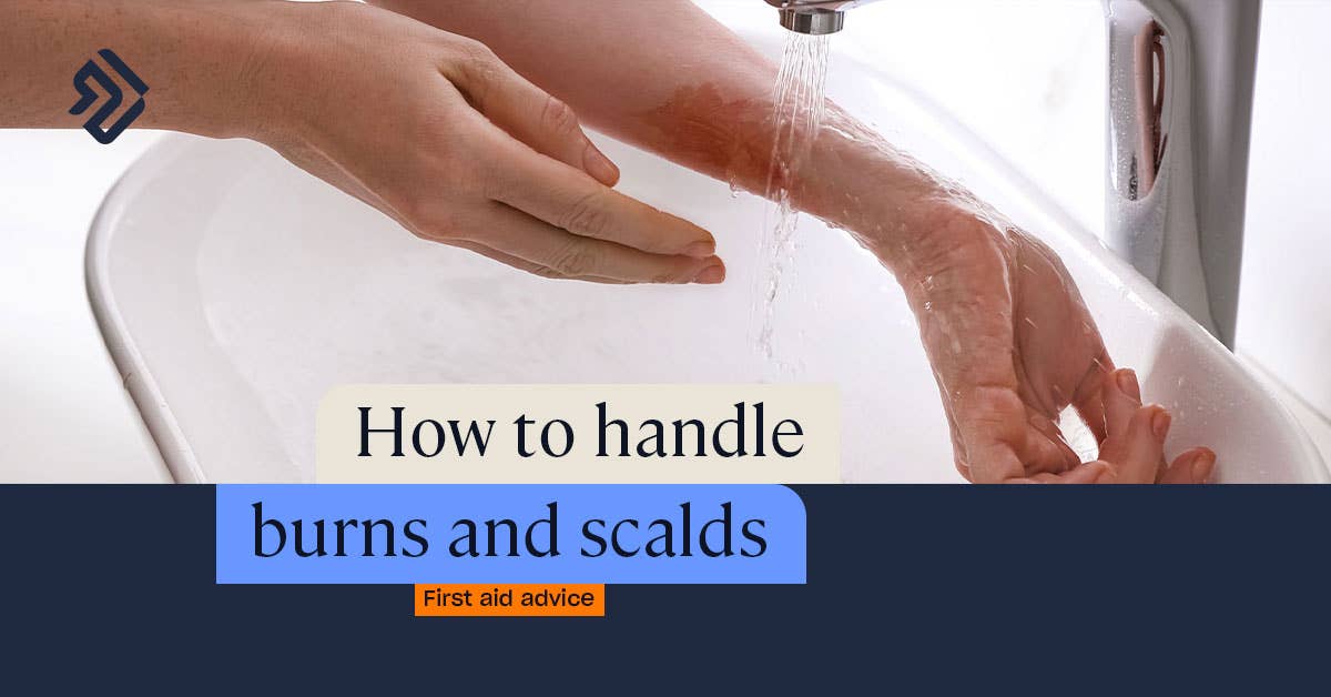 What are Burns and Scalds? | Causes, Types & How to Treat