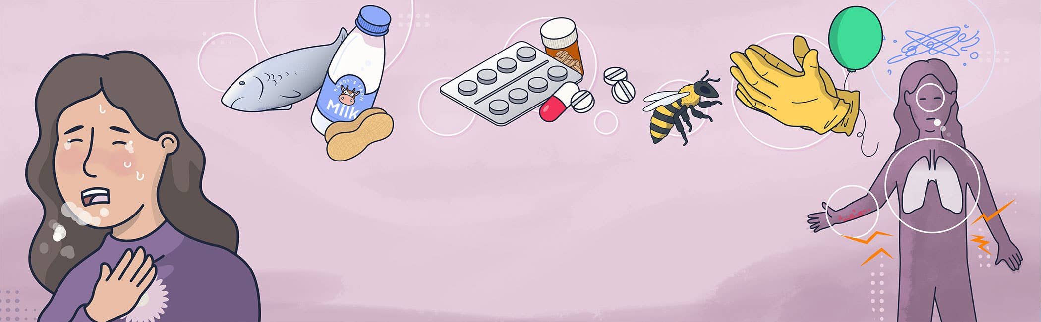 What is Anaphylaxis in Children? | Causes, Signs & How to Treat